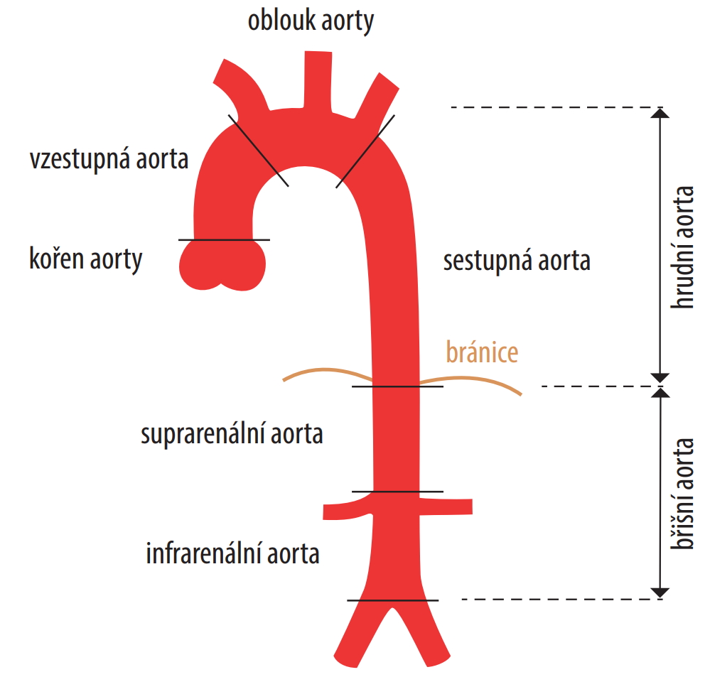 Onemocnění aorty – srdečnice - Sdružení pro srdeční rytmus, spolek